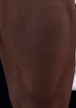 Second Life Marketplace - Aesthetic Body Mod - Full Body Freckles