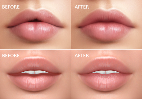 Second Life Marketplace - Izzie's - DEMO Inside Lips Corrector