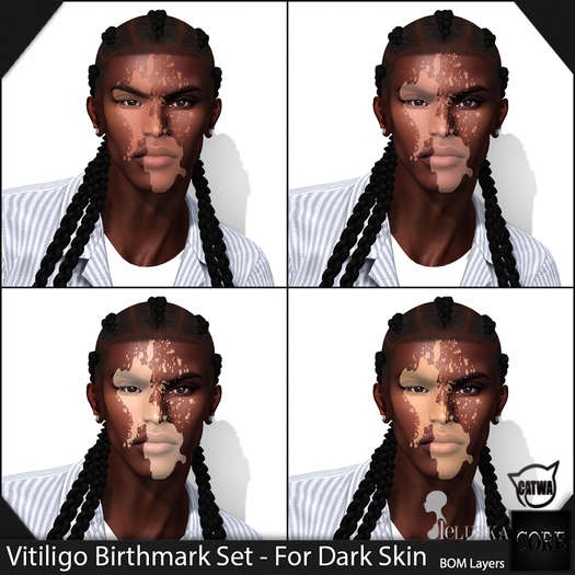 Second Life Marketplace - ::: Core ::: Vitiligo Birth Mark Set (for ...