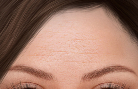 Second Life Marketplace - Izzie's - Forehead Lines (BOM & Omega)