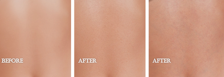 Second Life Marketplace - Izzie's - BOM Body Pores & Details