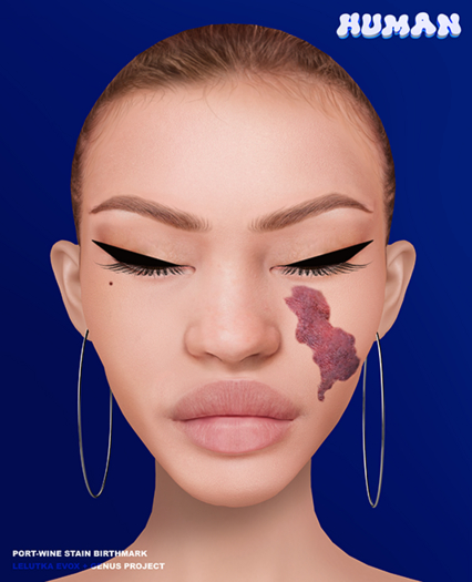 Second Life Marketplace - [HUMAN] Port-wine Stain Birthmark - Genus