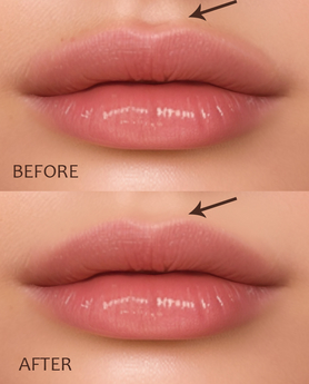 Second Life Marketplace - Izzie's - Upper Lip Shadow Concealer (Evo X BOM)