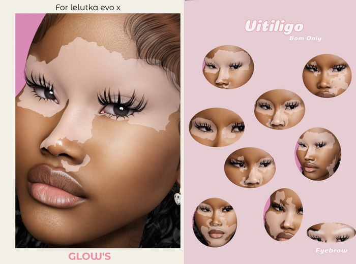 Second Life Marketplace - GLOW'S-VITILIGO PACK EVO X