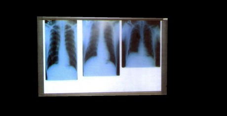 Second Life Marketplace - Hospital equipment texture xray screen full perms